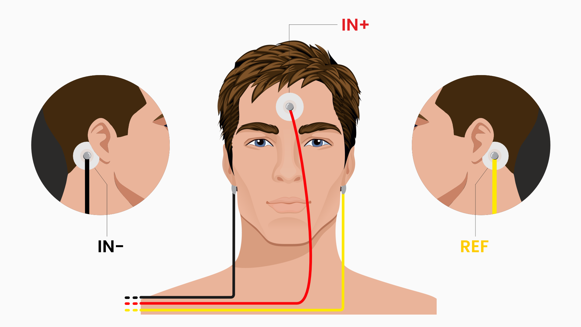 Control the Flame of a Candle Using Your Focus (EEG) : 8 Steps (with ...