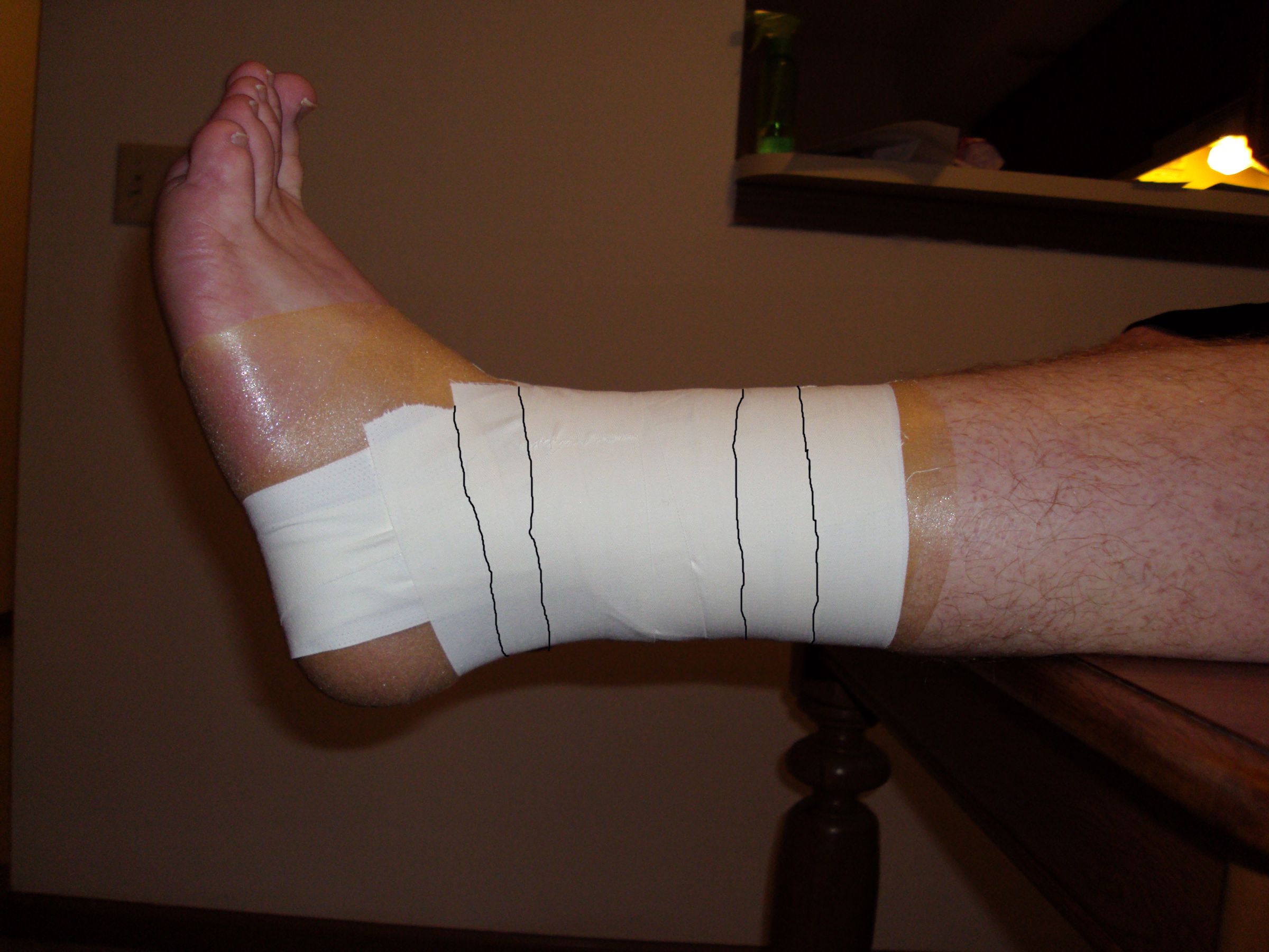 How to Tape an Ankle : 8 Steps - Instructables