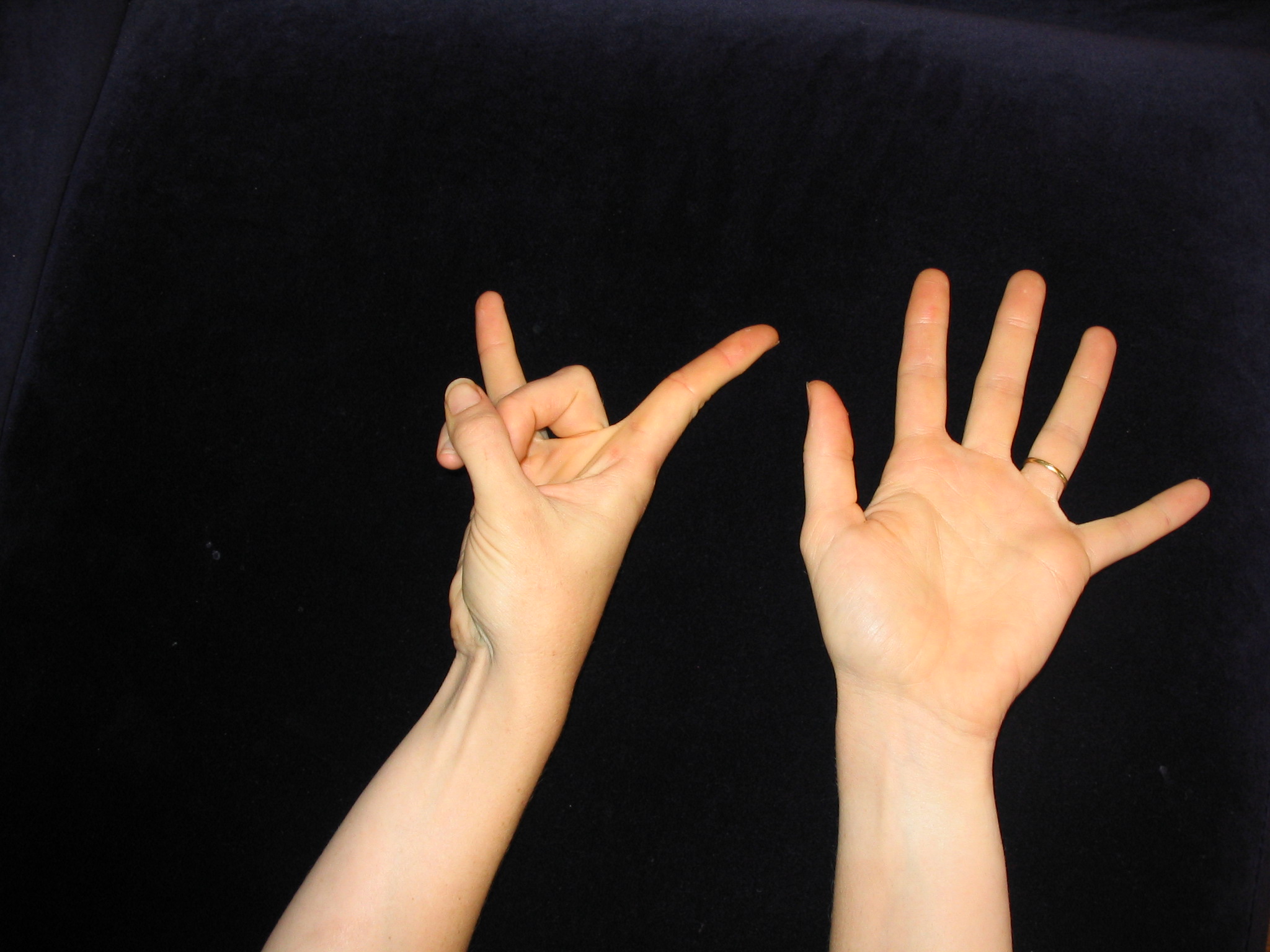 Mouse Toe Numbering Scheme : 5 Steps - Instructables