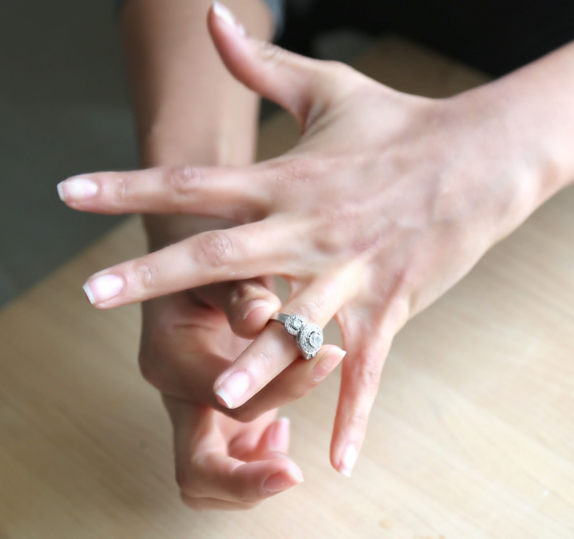 How to Remove a Stuck-On Ring : 5 Steps (with Pictures) - Instructables