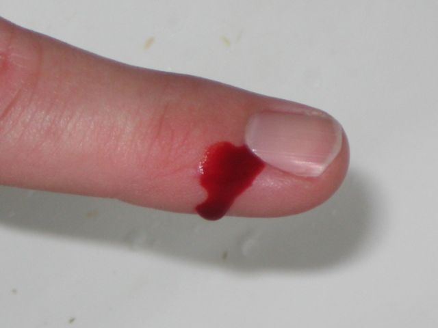 Healing a Cut at Home : 3 Steps - Instructables