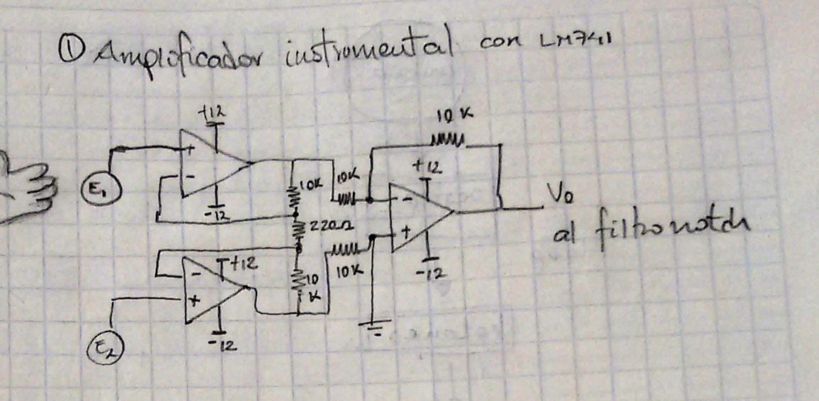 DIY ECG + Arduino + LabView : 8 Steps - Instructables
