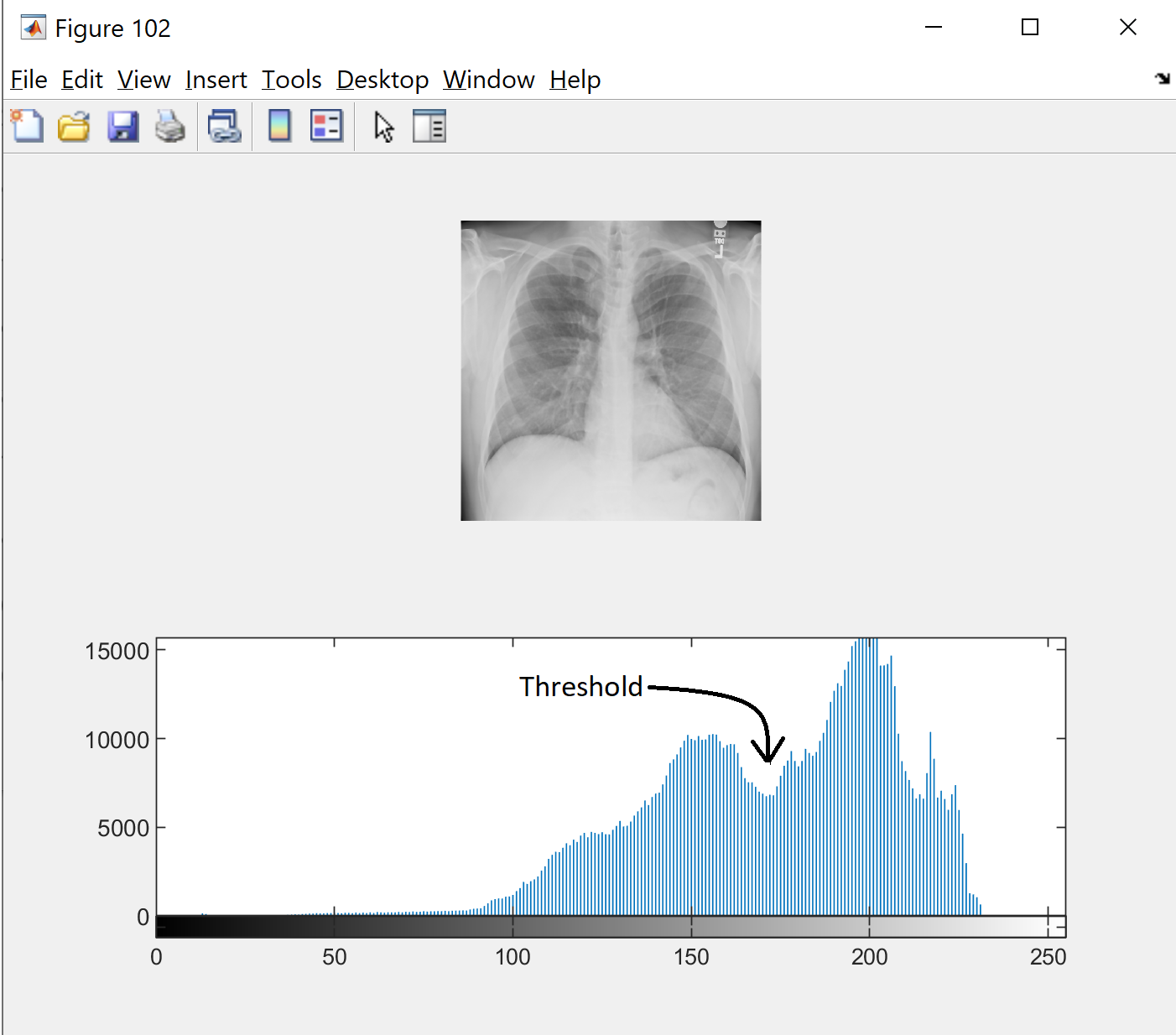 MatLab Lung Segmentation : 5 Steps - Instructables
