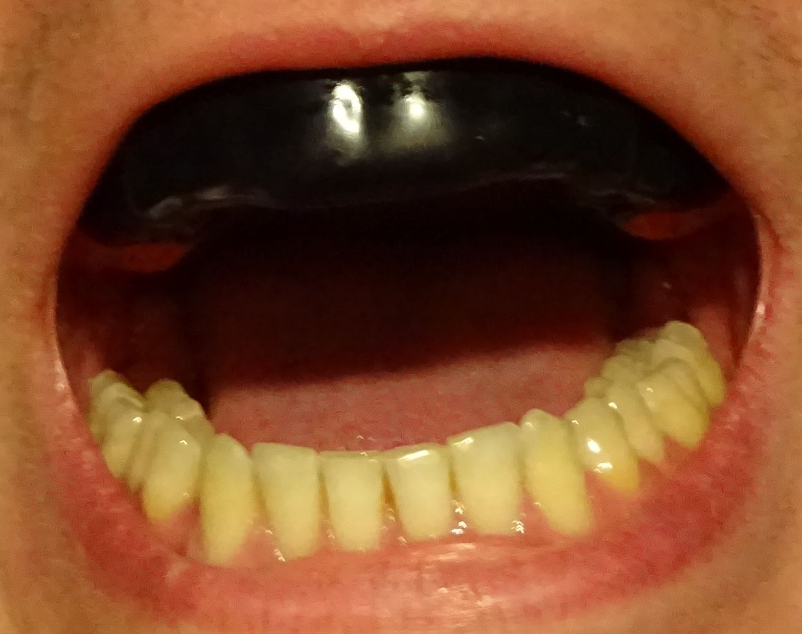 Clicker ( the Last of Us) Mask and Costume : 7 Steps (with Pictures ...