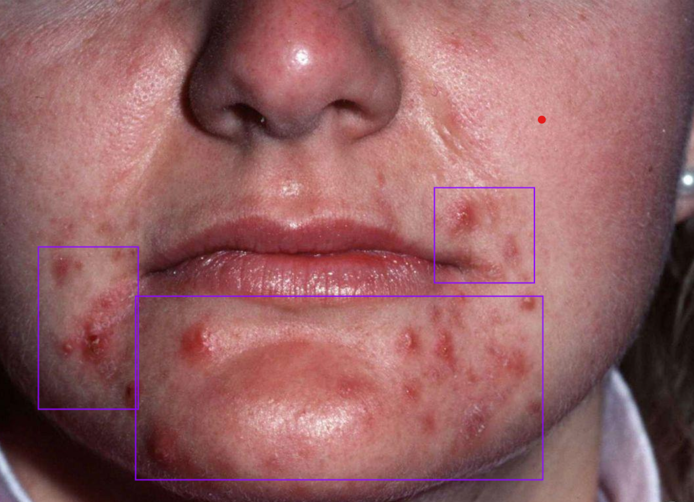 Skin Image Recognition : 9 Steps - Instructables