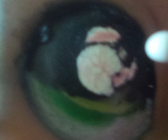 How to Fix a LPS Eye : 3 Steps - Instructables
