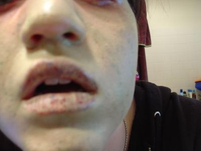 As Realistic As Zombie Makeup Gets! : 8 Steps (with Pictures ...