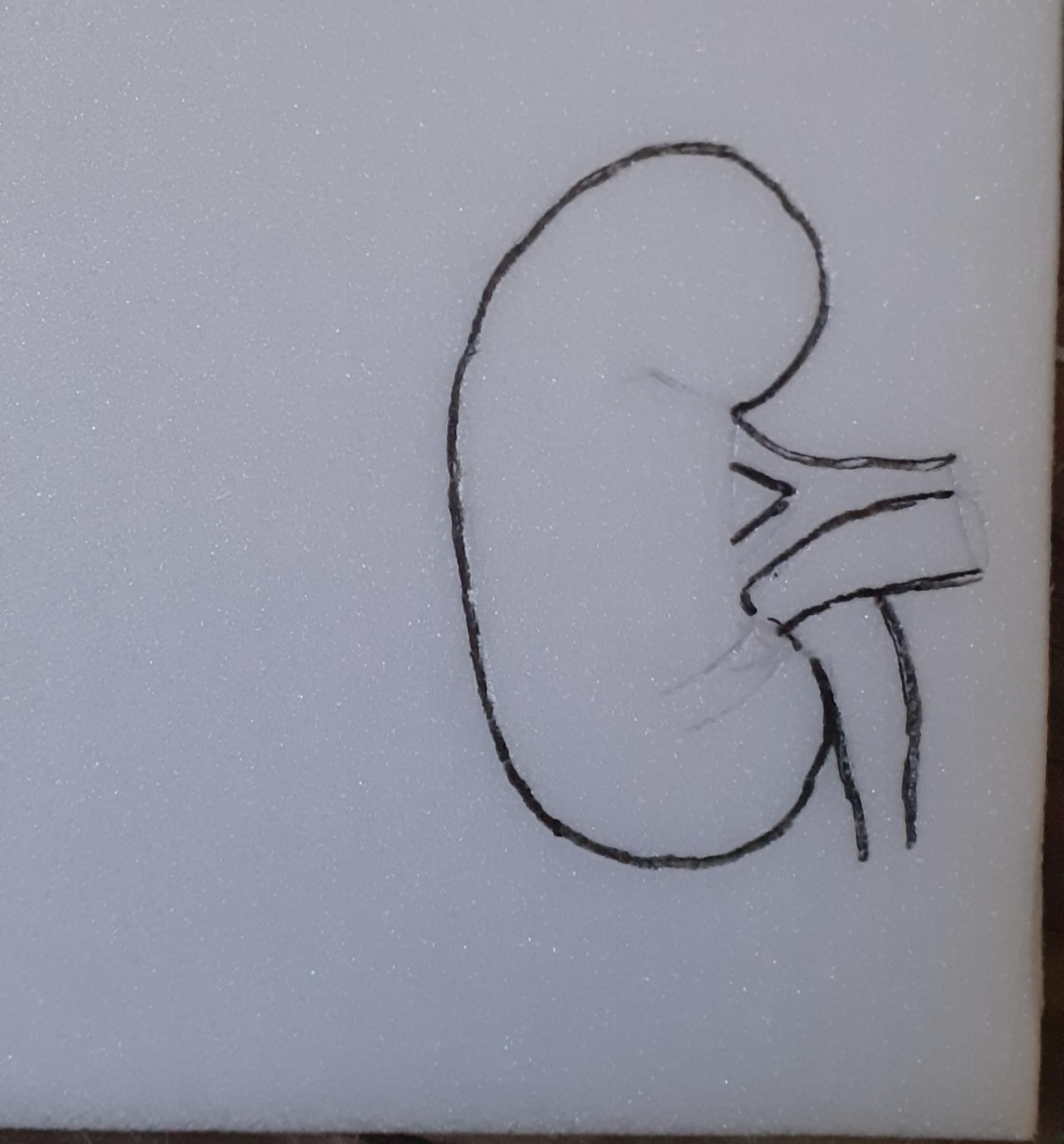 How to Make Simple KIDNEY Moulage : 10 Steps (with Pictures ...