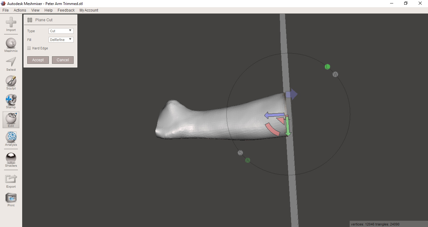 How to Design Custom, 3D Printable Braces for Arm Injury : 8 Steps ...