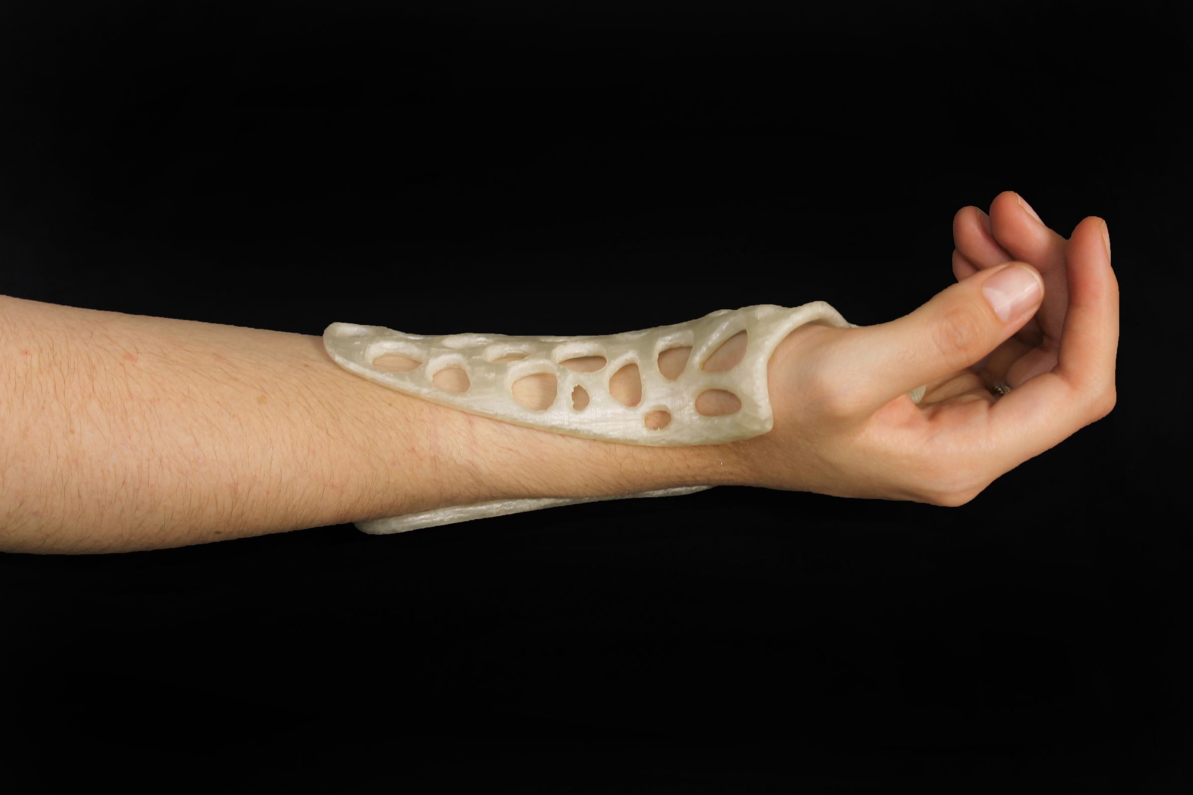 3D Printed Wrist Orthosis : 12 Steps (with Pictures) - Instructables