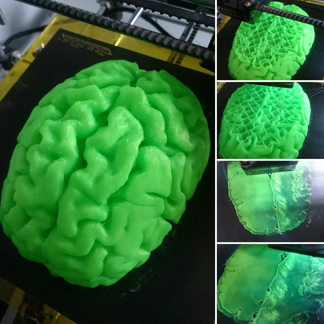 3D Print Your Own Brain : 5 Steps (with Pictures) - Instructables