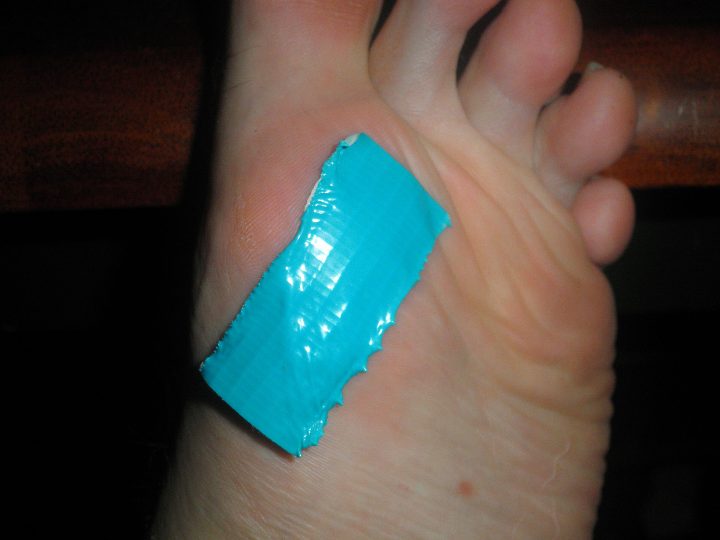 Duct Tape in Your First Aid Kit : 8 Steps (with Pictures) - Instructables