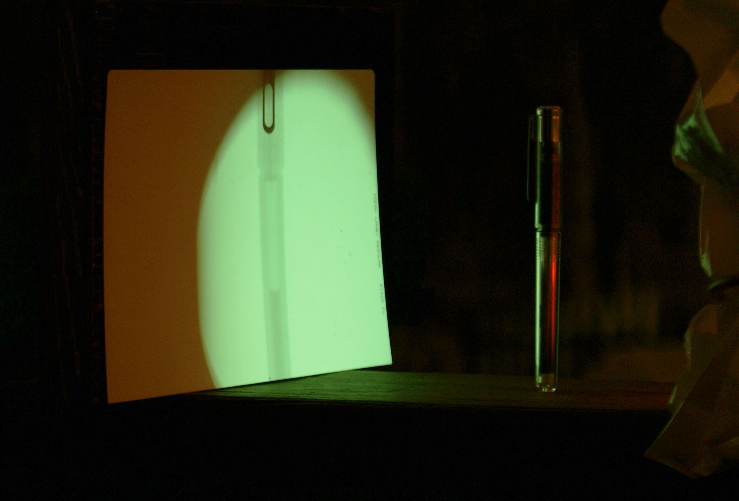 How to X-Ray : 27 Steps (with Pictures) - Instructables