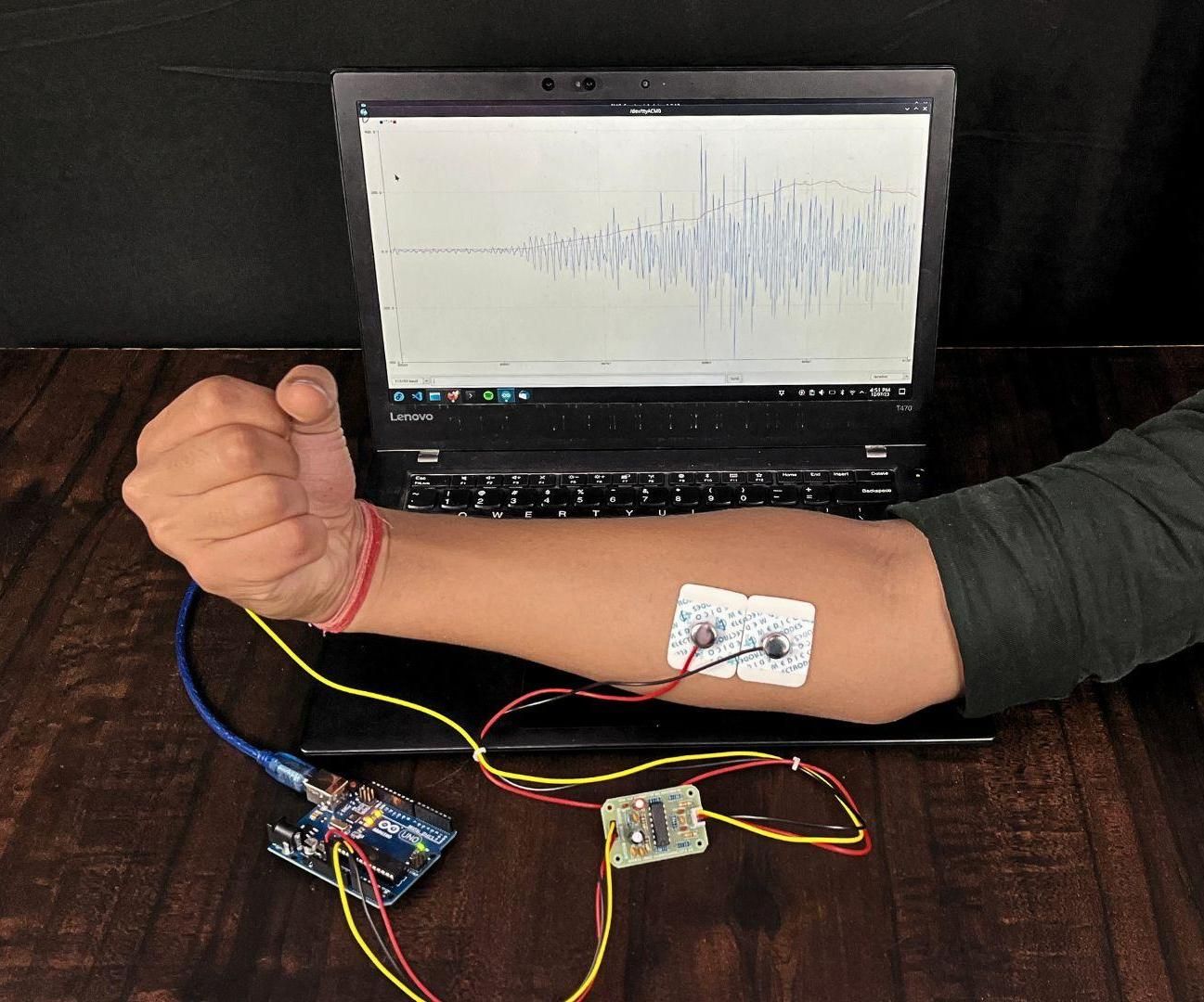 Visualizing Muscle Signals (EMG) Using Most Affordable DIY Muscle Sensor : 9 Steps (with ...