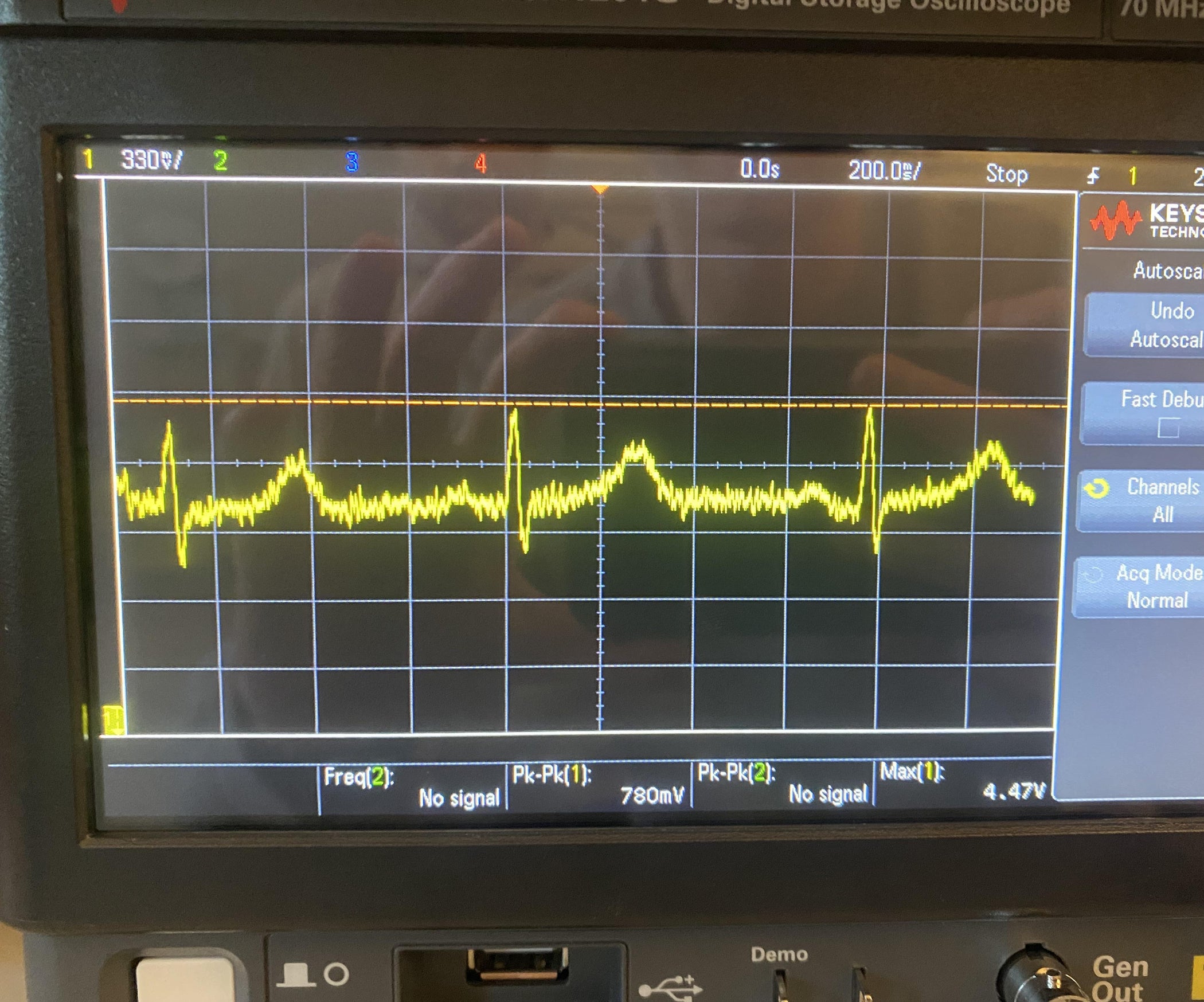 How to Make an Electrocardiogram (ECG) : 7 Steps - Instructables