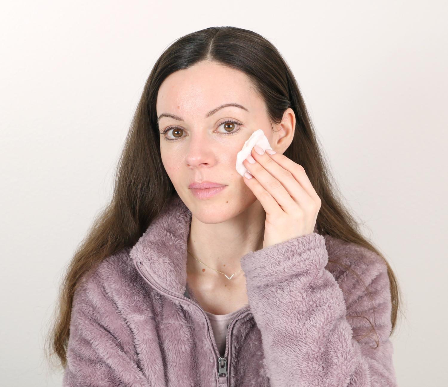 Nano Needling at Home - How to & My Results : 3 Steps (with Pictures ...