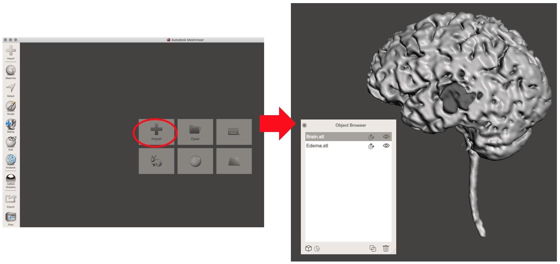 MRI to 3D Printable File : 14 Steps (with Pictures) - Instructables