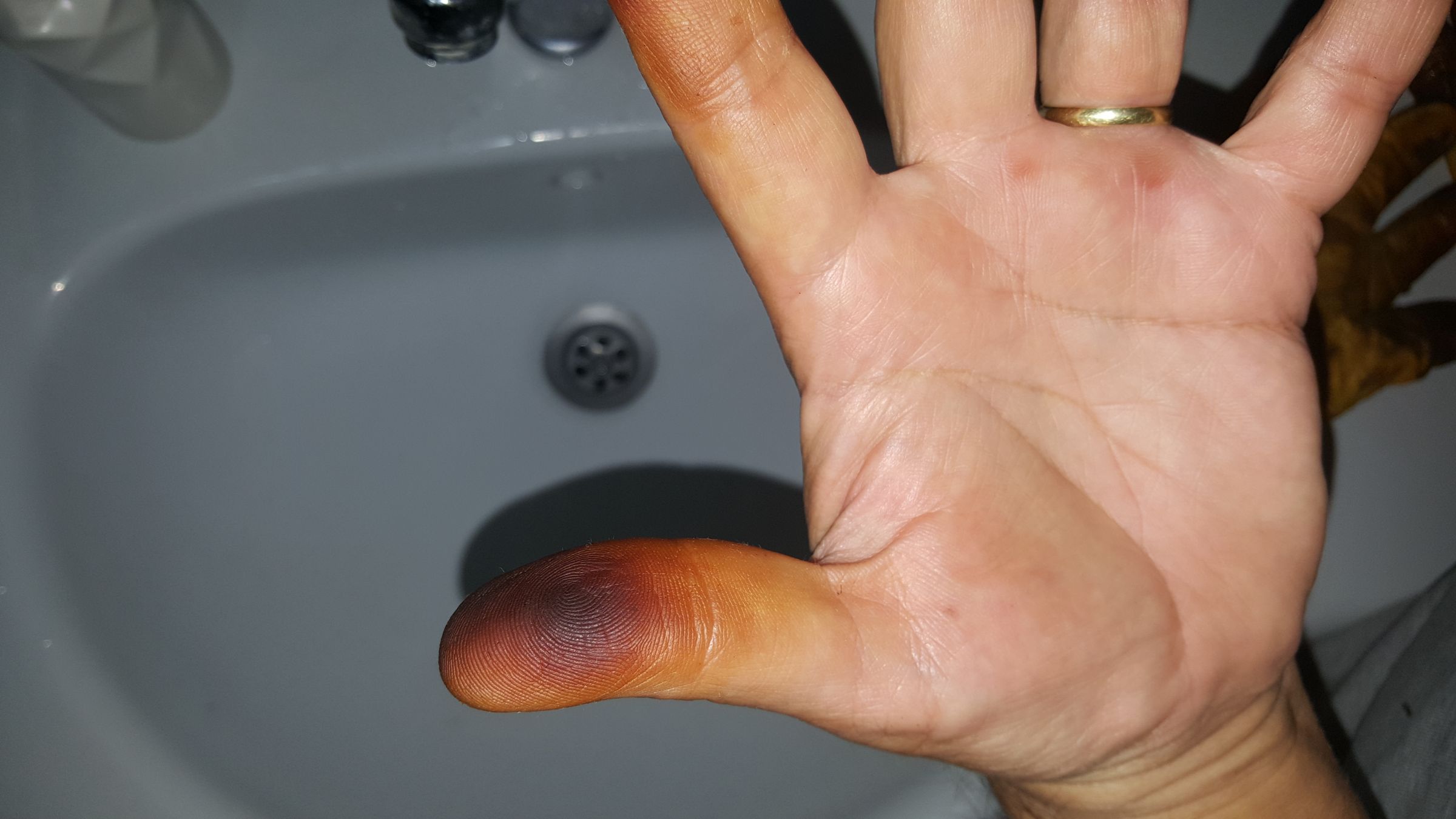 How to Extract Walnut : 6 Steps (with Pictures) - Instructables