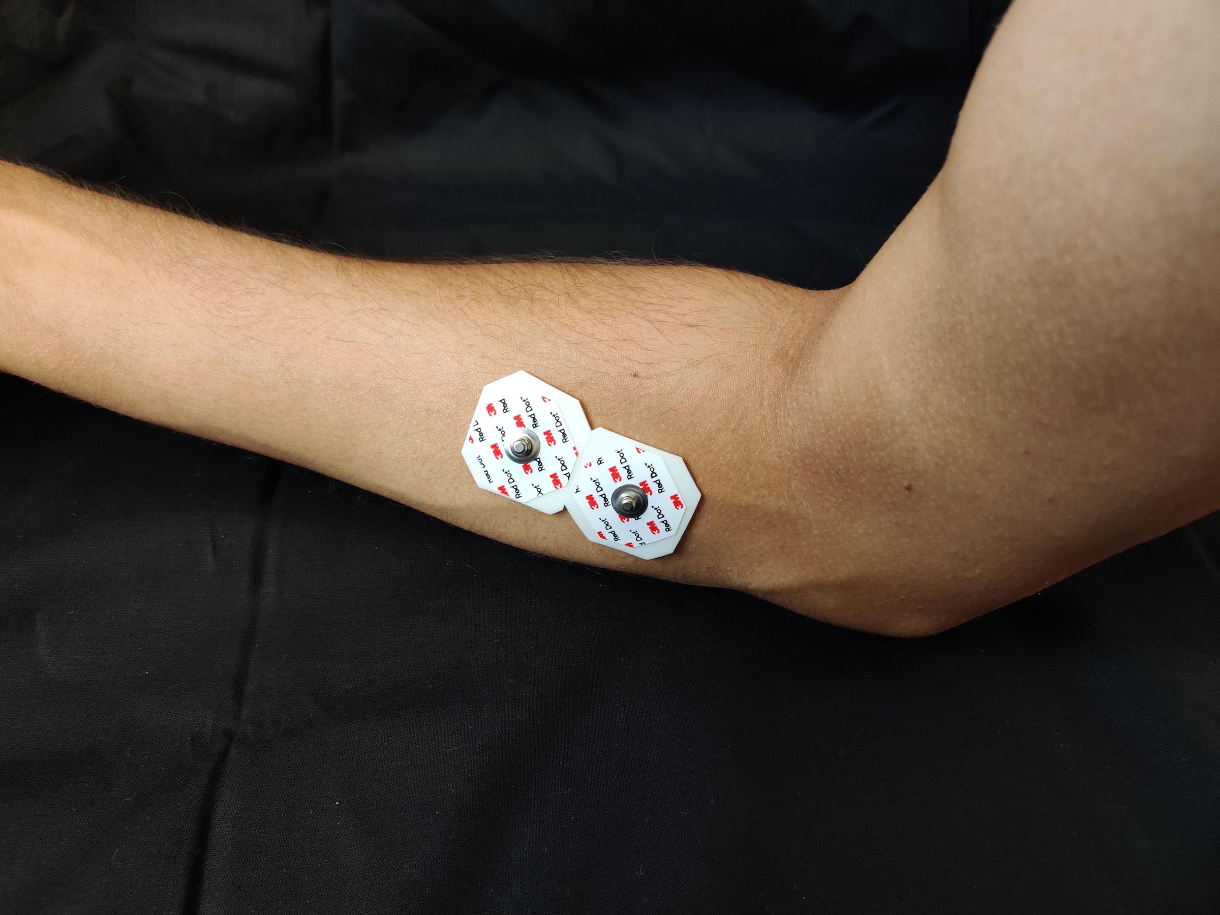 3D Printed EMG Prosthetic Hand : 5 Steps (with Pictures) - Instructables