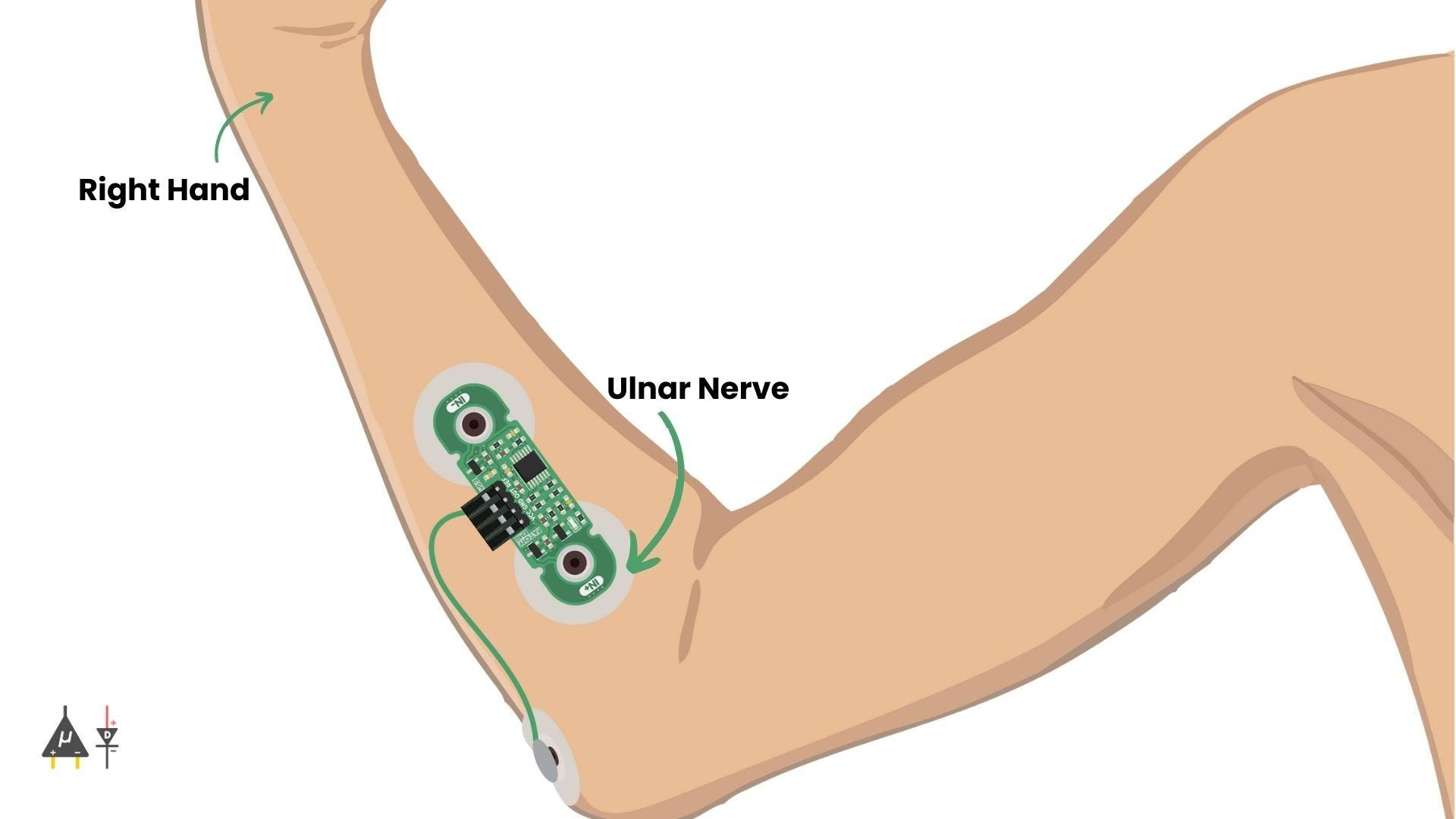 Recording and Visualizing Muscle Signals (EMG) Using Muscle BioAmp ...