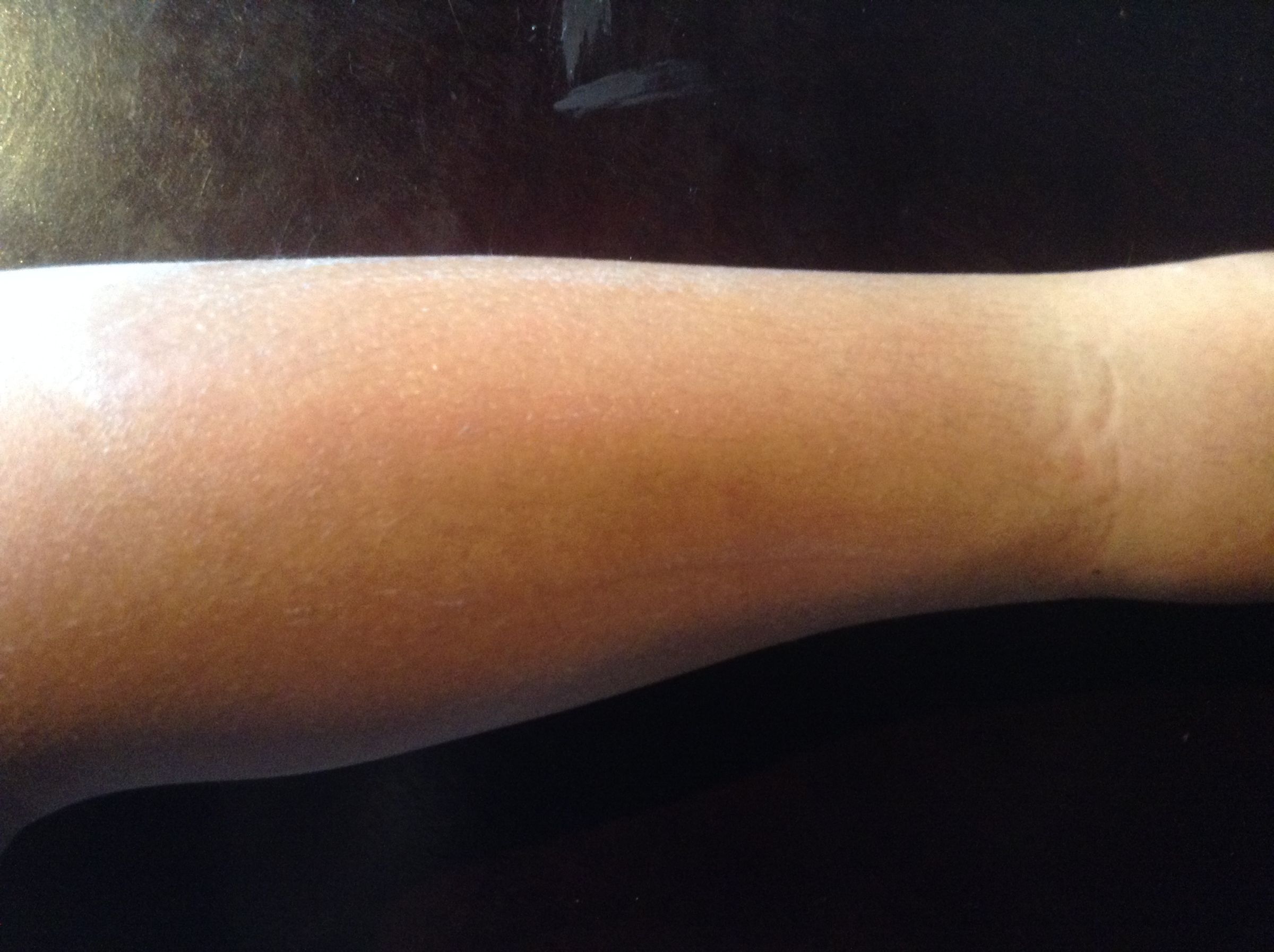 How to Scrape Your Arm : 5 Steps - Instructables