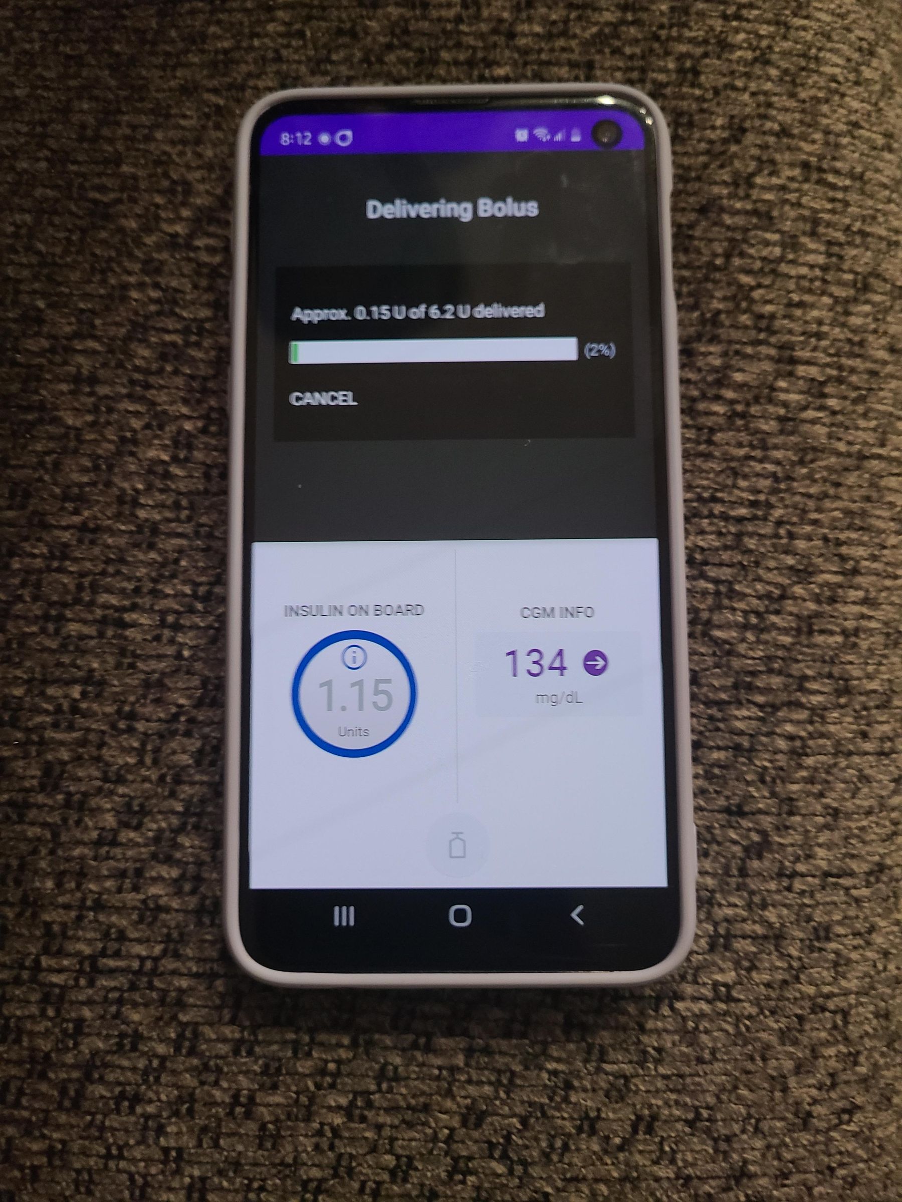 How to Use an Omnipod 5 : 6 Steps - Instructables