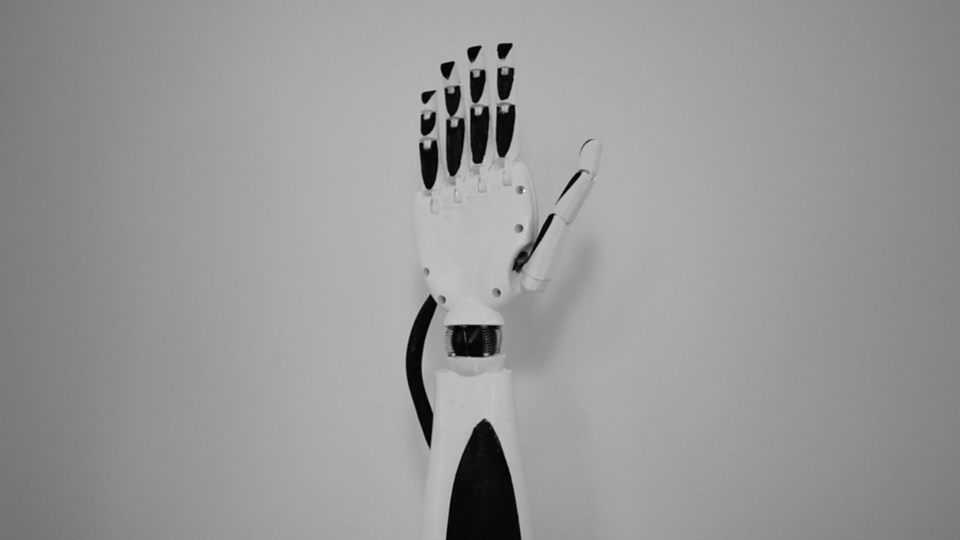 Robotic Arm 3D Printed (DIY Initial Prosthetic Prototype) : 12 Steps ...