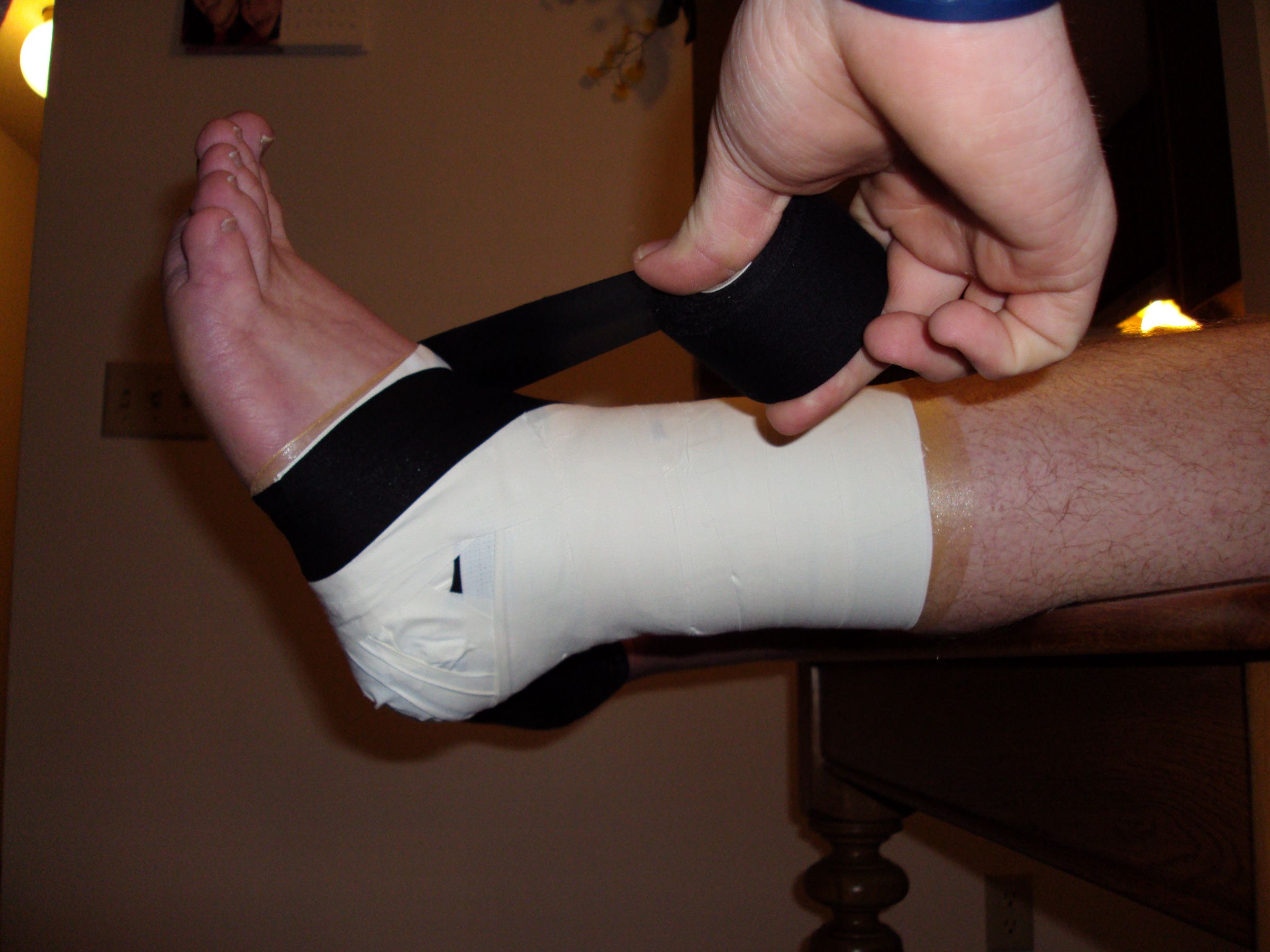 How to Tape an Ankle : 8 Steps - Instructables