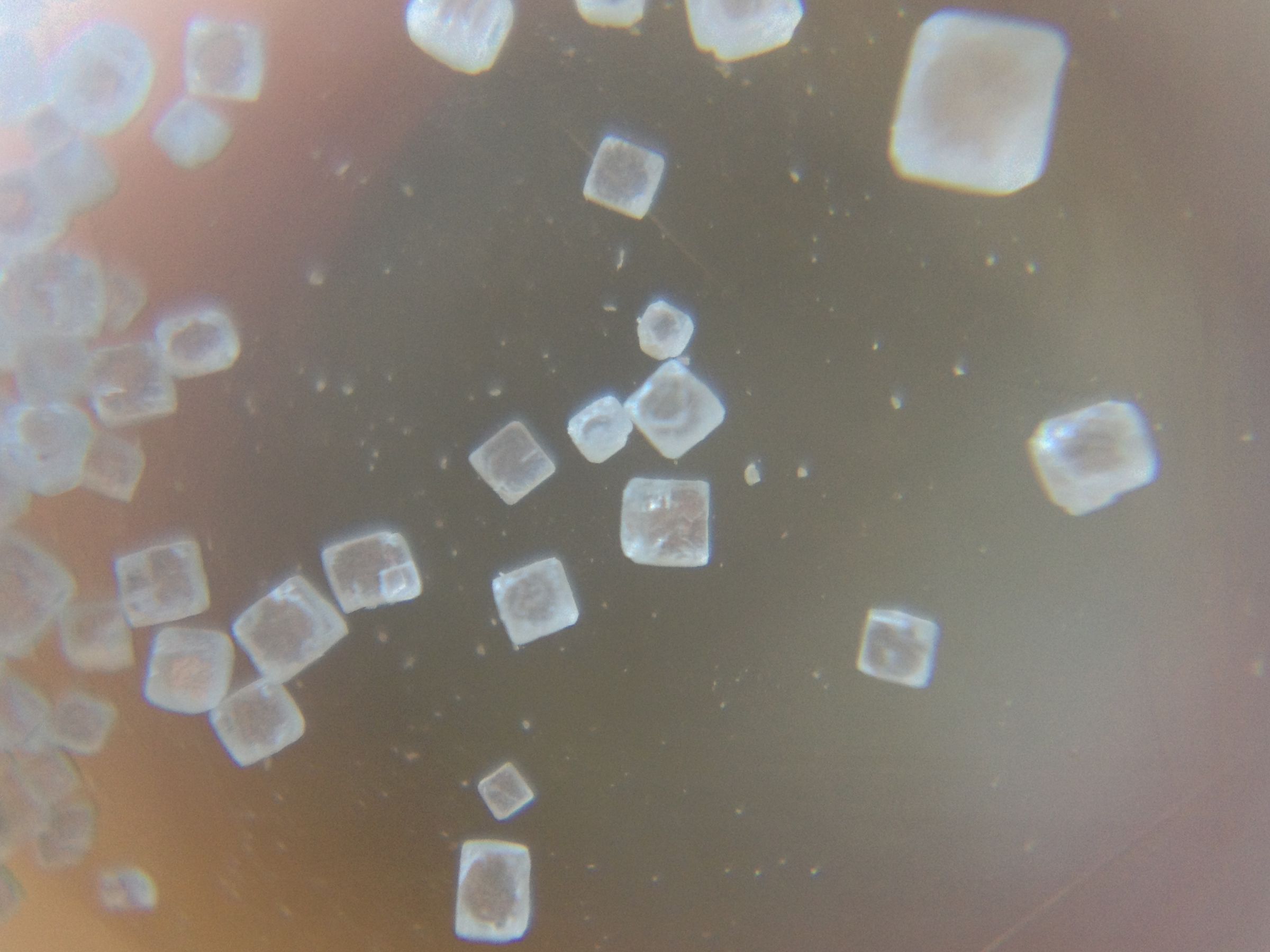 $10 Smartphone to Digital Microscope Conversion! : 9 Steps (with ...