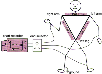 Designing an ECG: Extra Cool Gizmo : 6 Steps - Instructables
