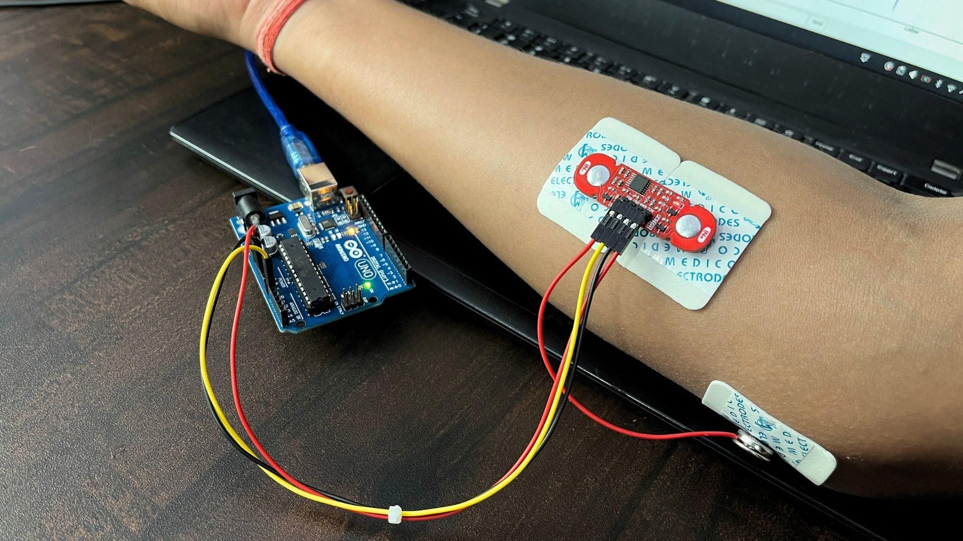 Recording and Visualizing Muscle Signals (EMG) Using Muscle BioAmp ...