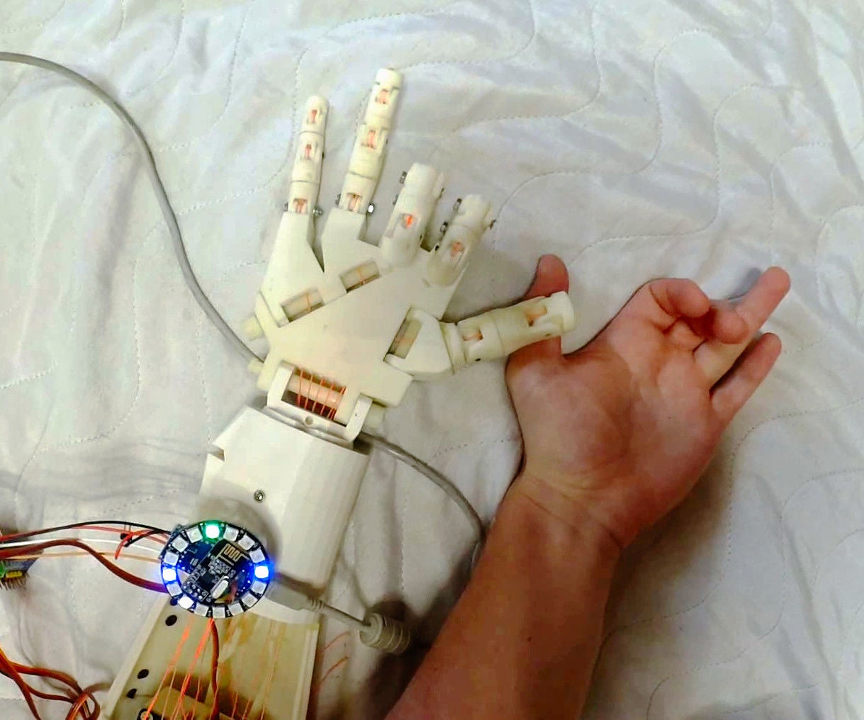 Robotic Hand Control With EMG : 7 Steps - Instructables