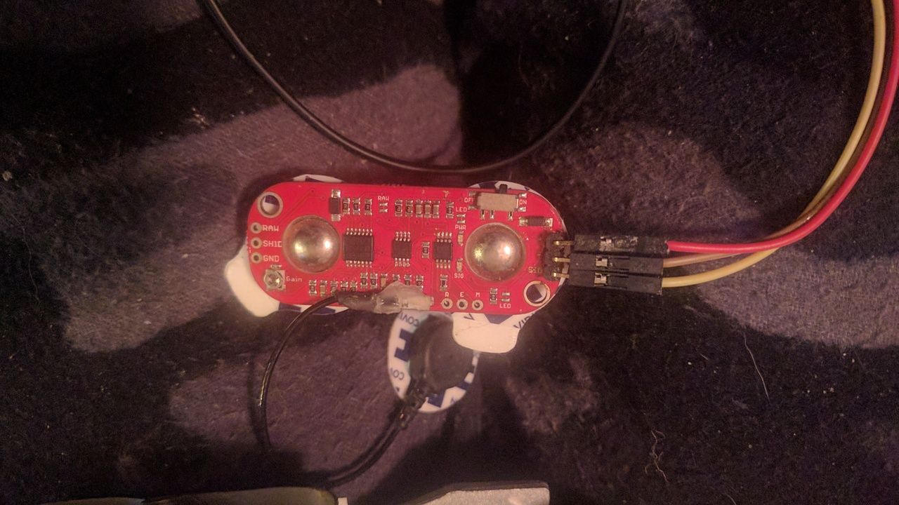 Robotic Prosthetic Hand With Claw or 3d Printed Hand : 5 Steps ...