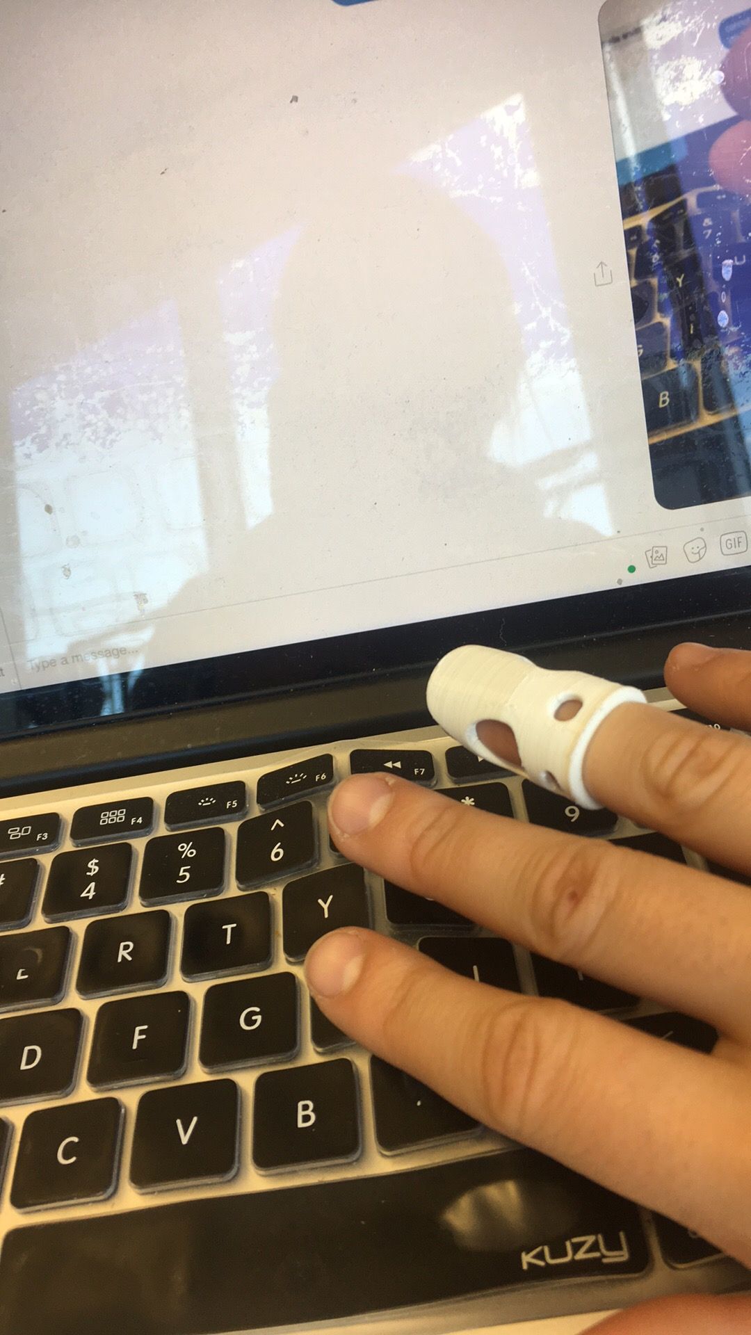 Custom 3D Printed Finger Splint : 3 Steps (with Pictures) - Instructables