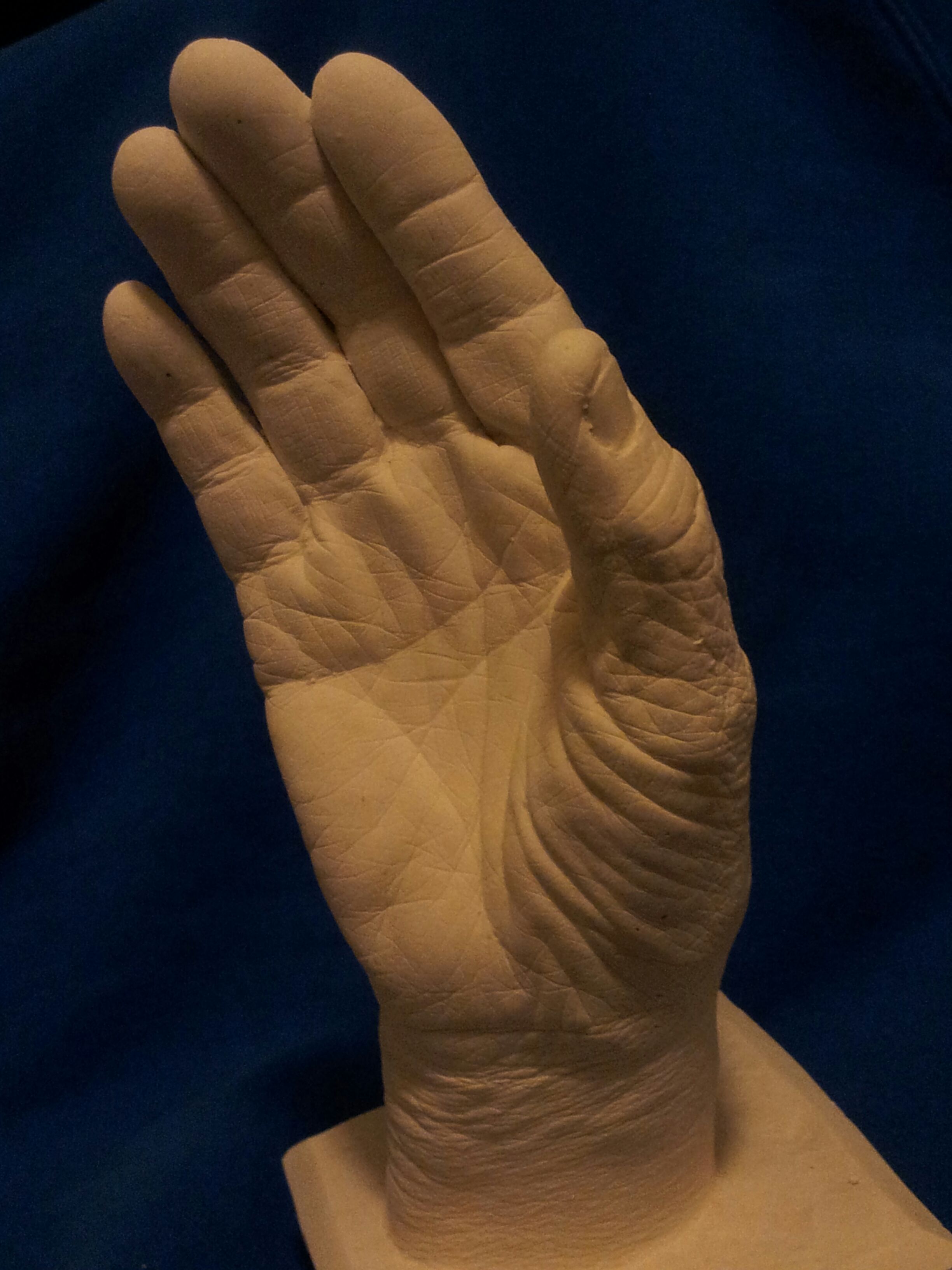 Plaster Alginate Casts of My Hand DIY : 5 Steps (with Pictures ...
