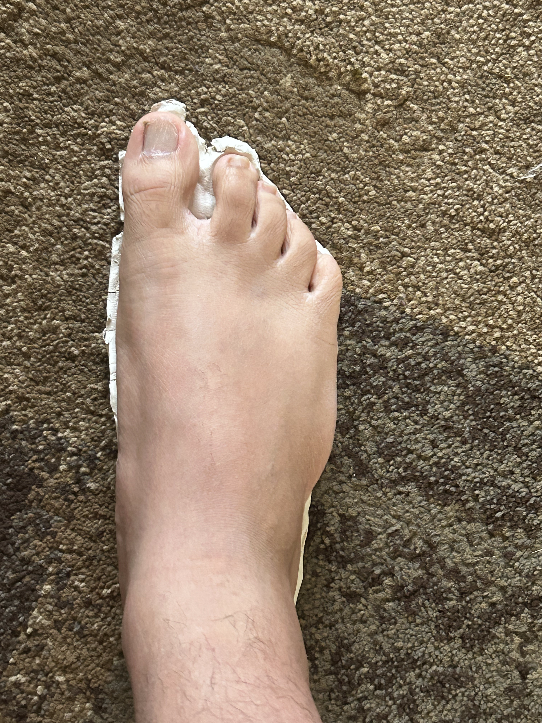 How to Make a Custom Shoe Insole With 3D Printing : 4 Steps - Instructables