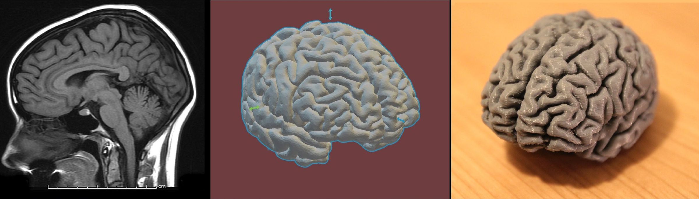 3D Print Your Own Brain : 5 Steps (with Pictures) - Instructables