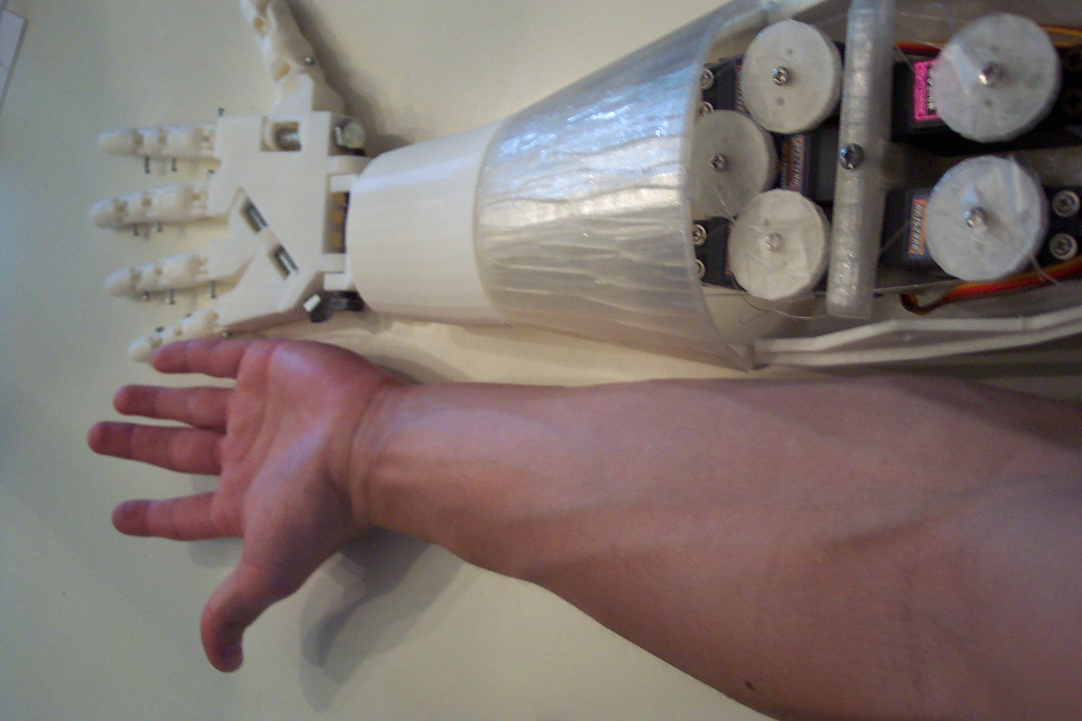 DIY Prosthetic Hand & Forearm (Voice Controlled) : 14 Steps (with ...