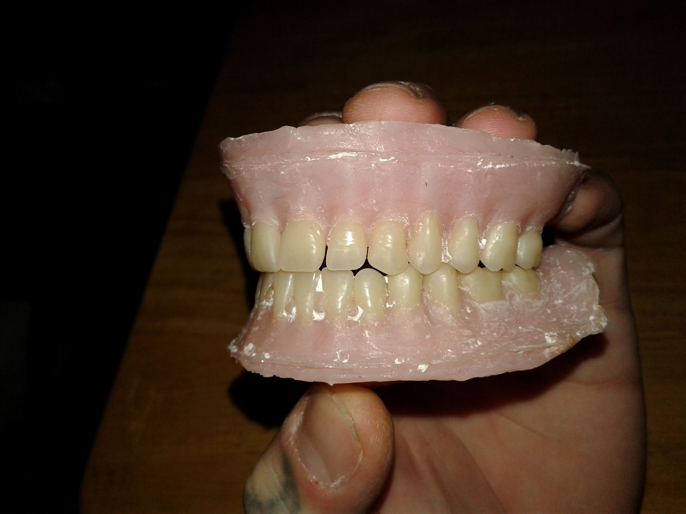 DIY Dentures : a Post-Surgical Plan : 12 Steps (with Pictures ...