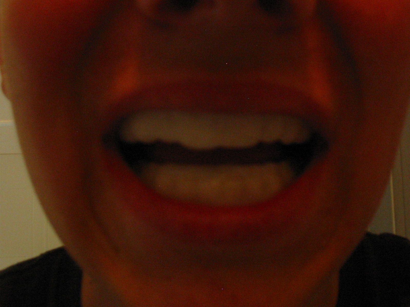 Make a Night Time Orthodontic Retainer : 3 Steps - Instructables