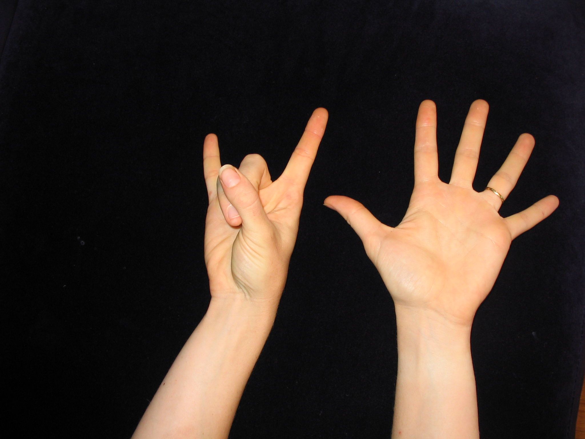 Mouse Toe Numbering Scheme : 5 Steps - Instructables