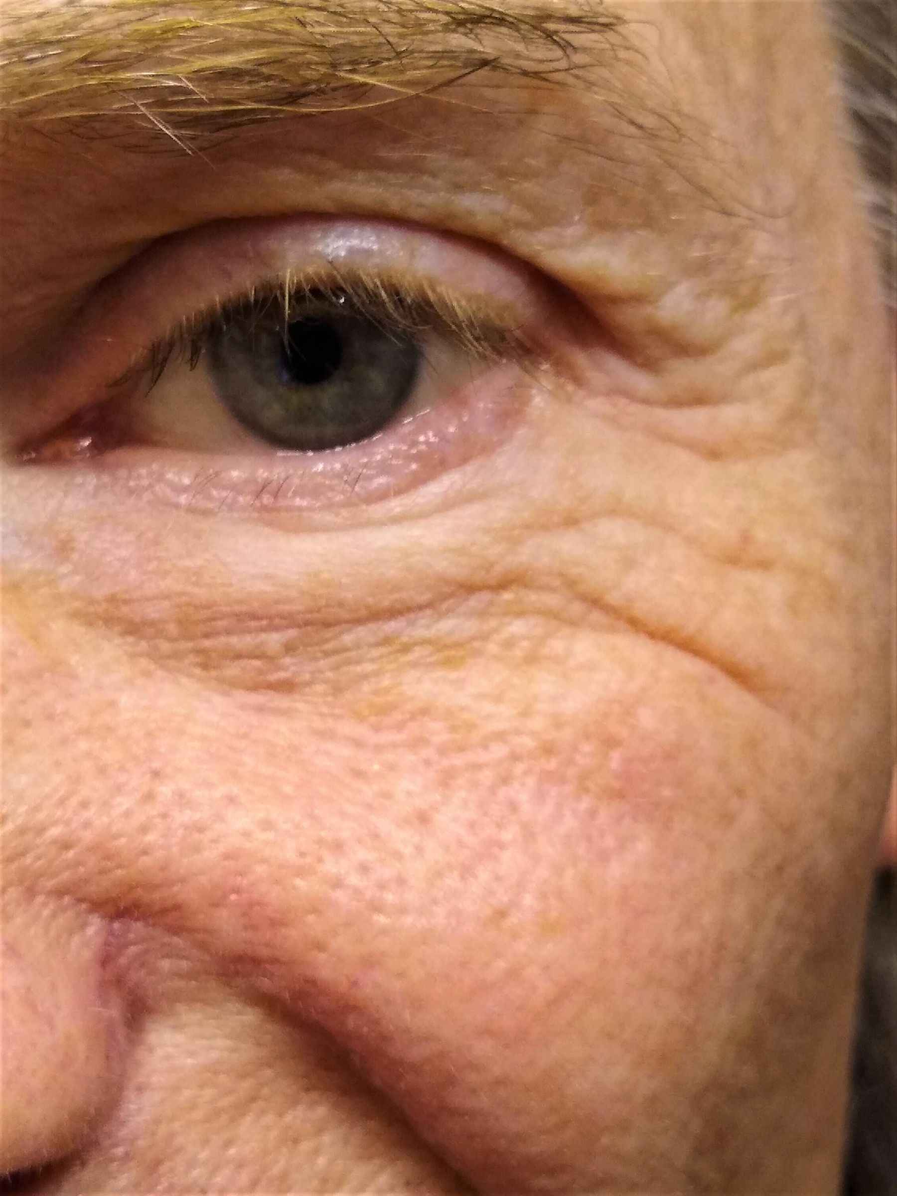 Stye Stone : 7 Steps (with Pictures) - Instructables