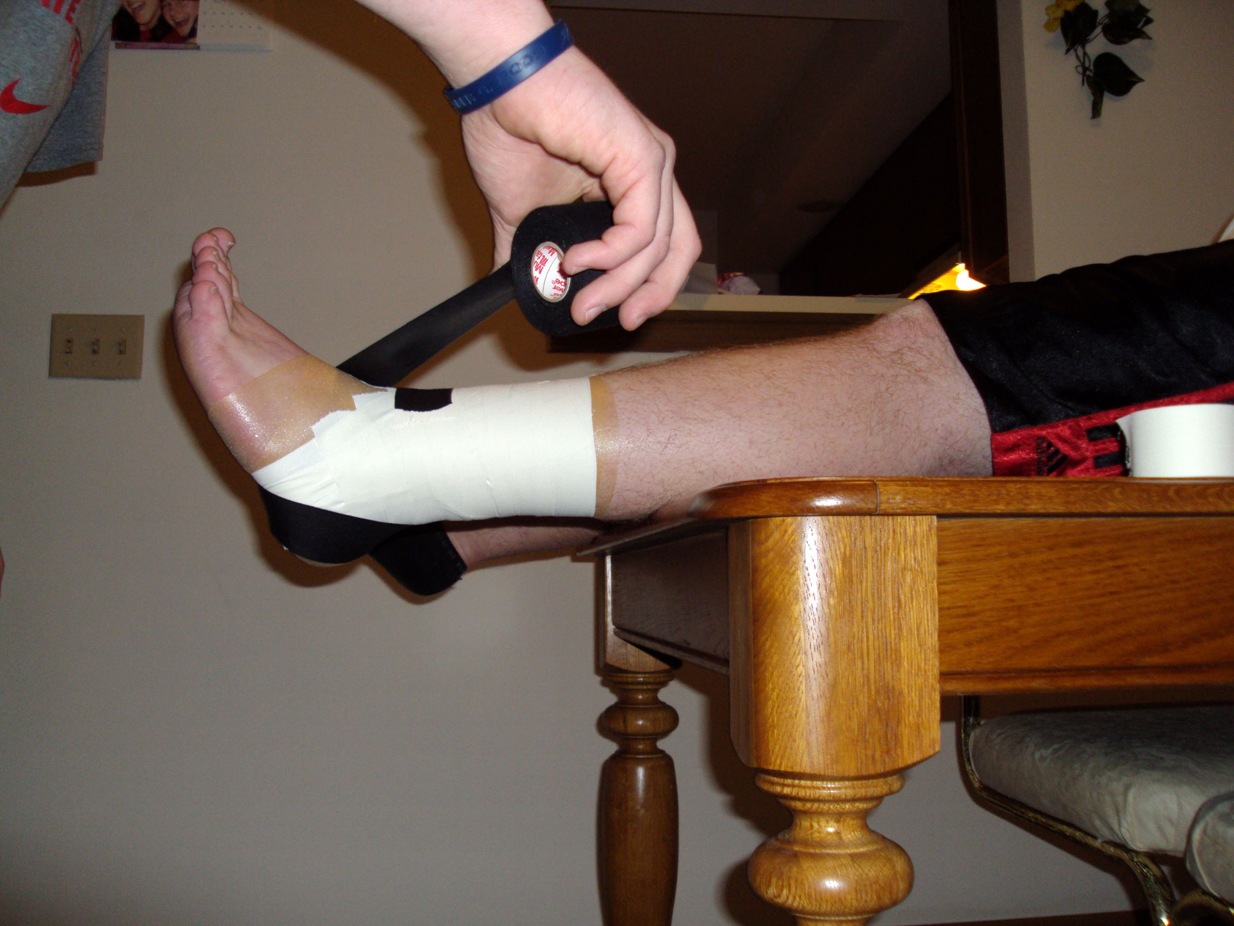 How to Tape an Ankle : 8 Steps - Instructables