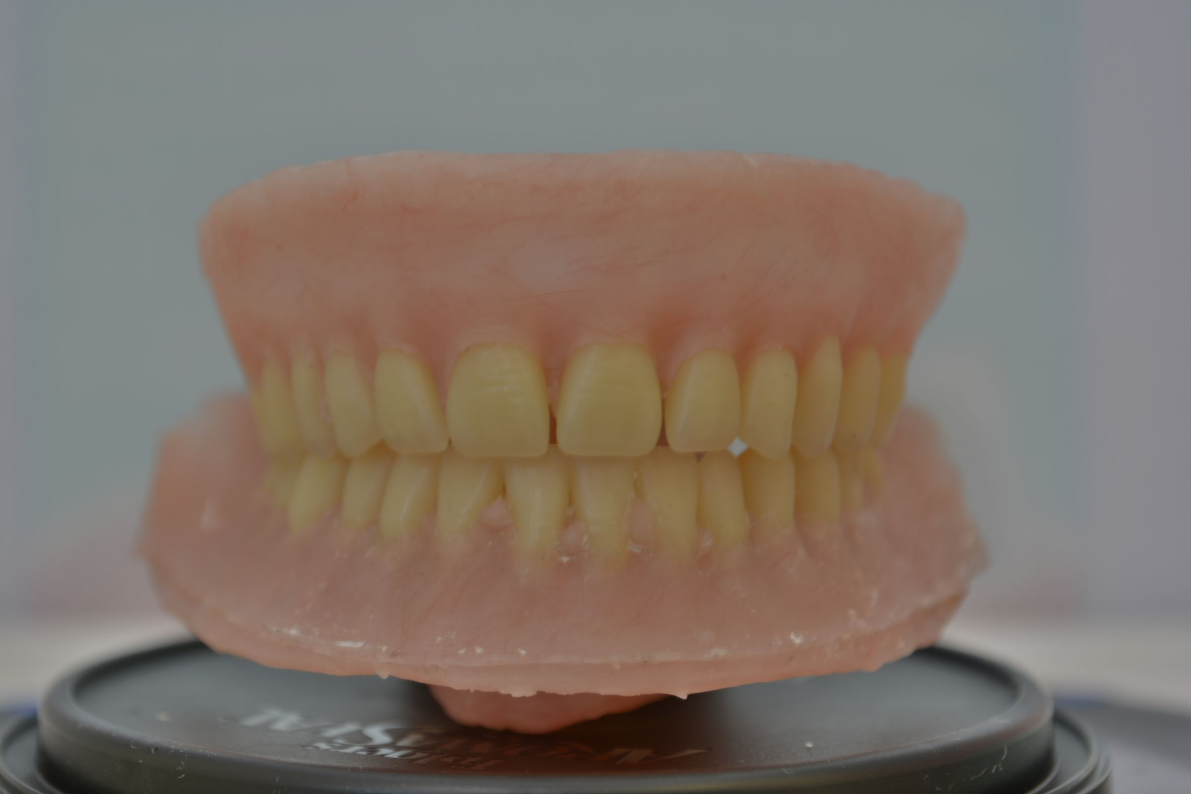 DIY Dentures : a Post-Surgical Plan : 12 Steps (with Pictures ...