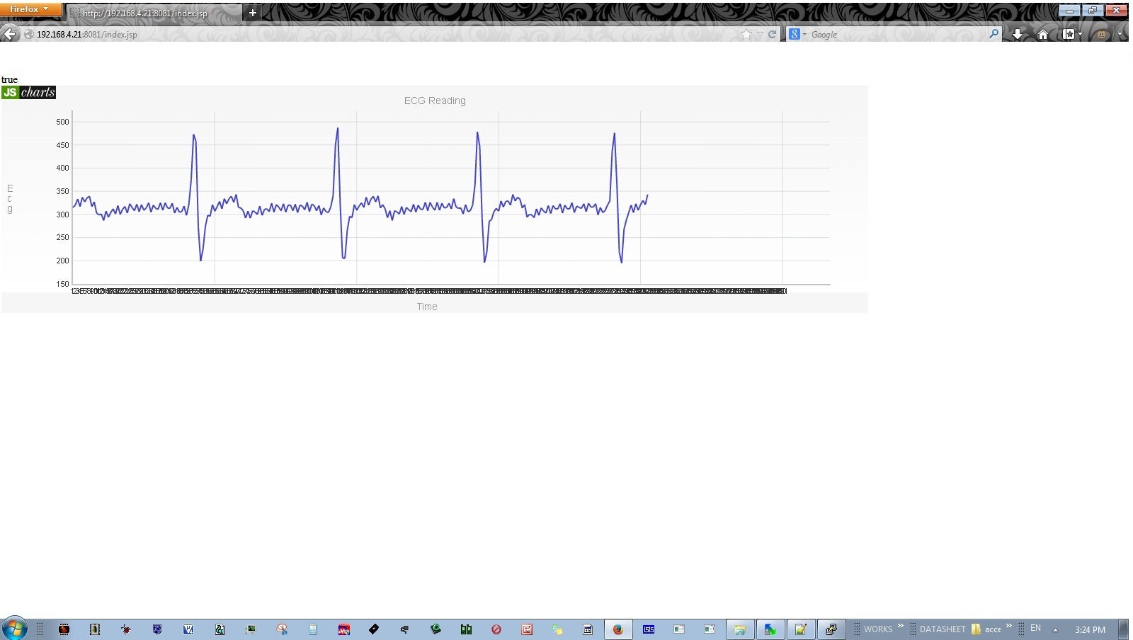 Raspberry Pi Real Time ECG Plotting - Instructables Raspberry Pi Real Time ECG Plotting - Instructables