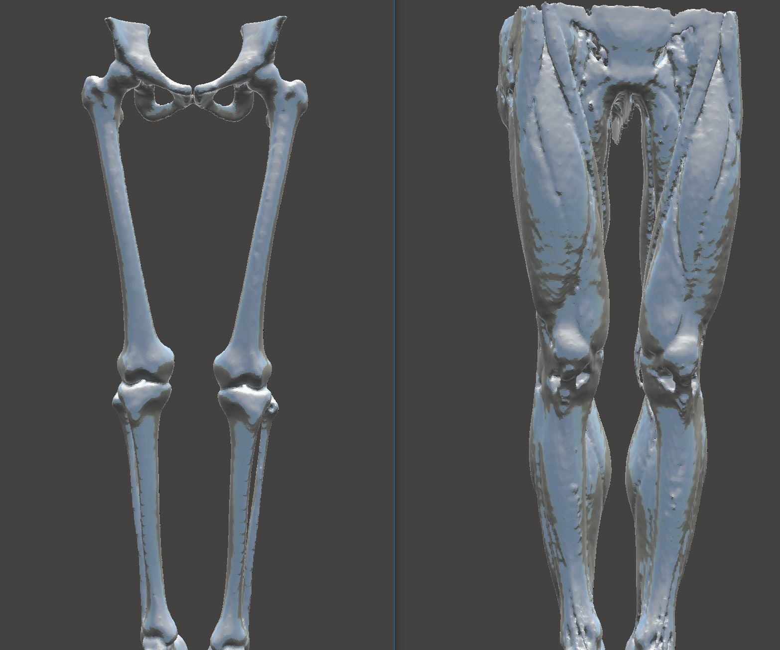 How to Easily and Automatically Convert a CT Scan (DICOM Data) Into a ...