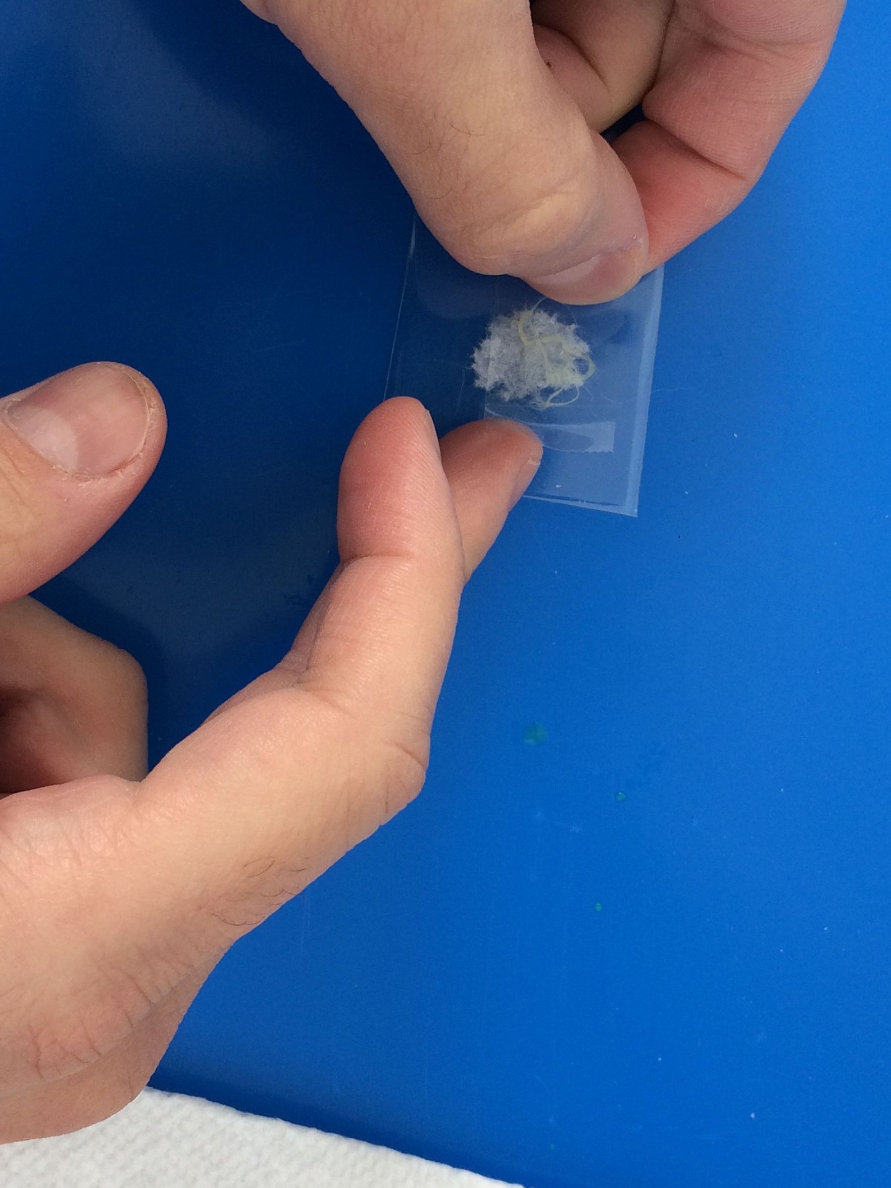 Low-cost Fluorescence and Brightfield Microscopes : 9 Steps (with ...