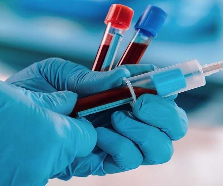 How to Perform Venipuncture (Laboratory Blood Testing) : 9 Steps ...