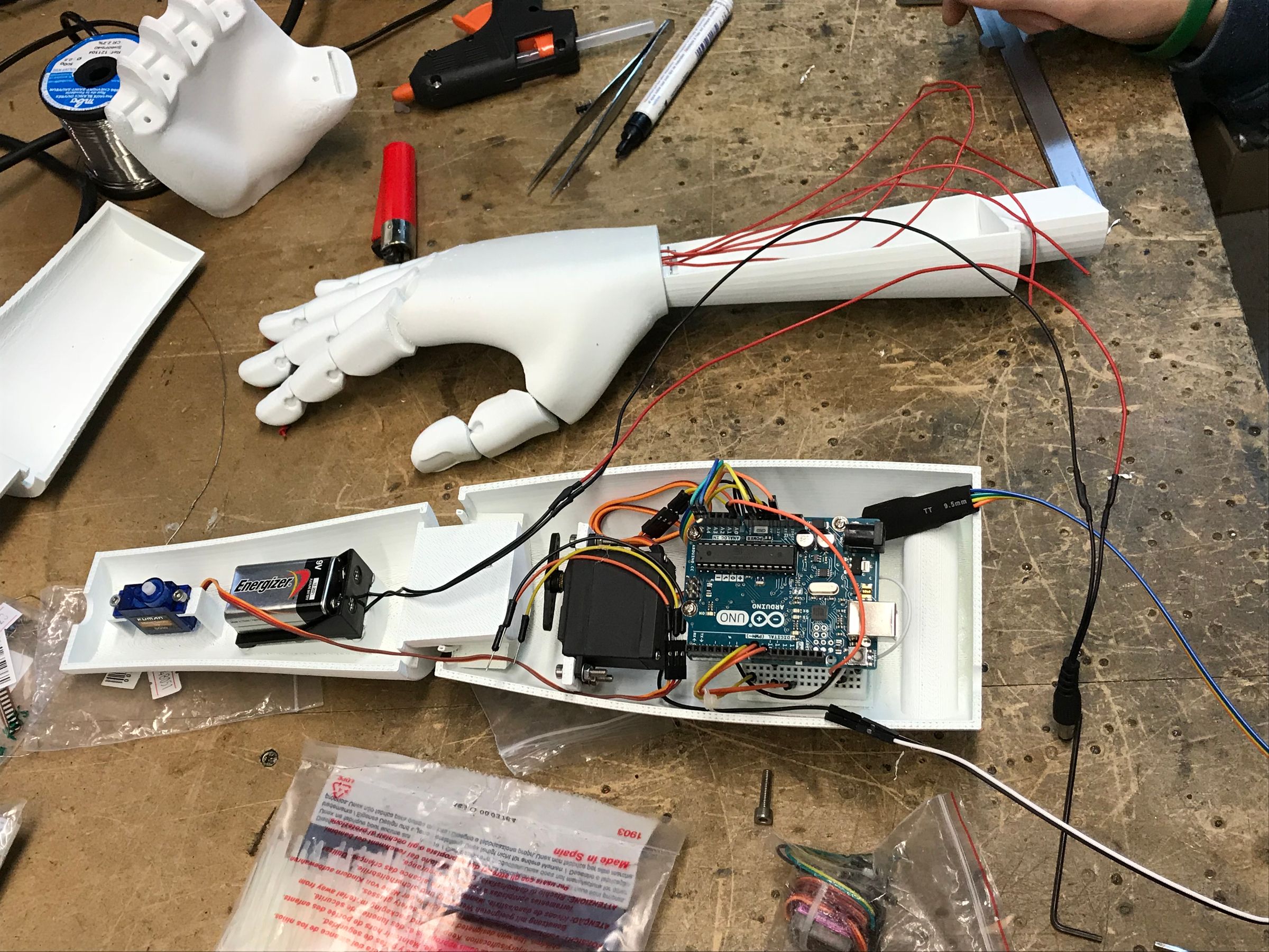 Prosthetic Arm - Marc Vilanova & Marc Mendez : 13 Steps - Instructables
