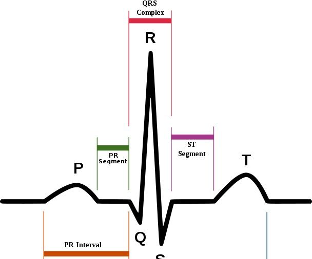 Arduino Portable EKG Monitor : 4 Steps (with Pictures) - Instructables